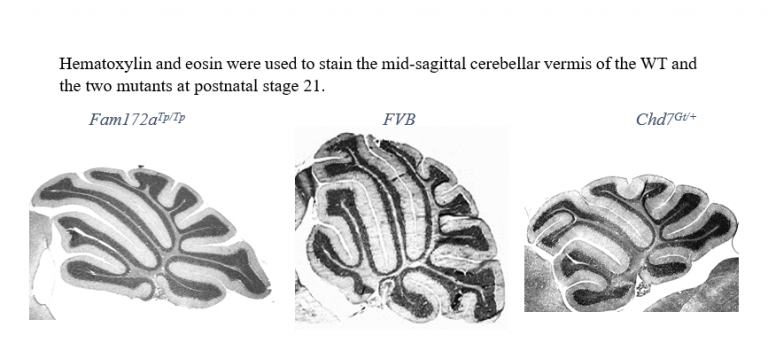 MEDNIK Syndrome (research program) - CERMO-FC
