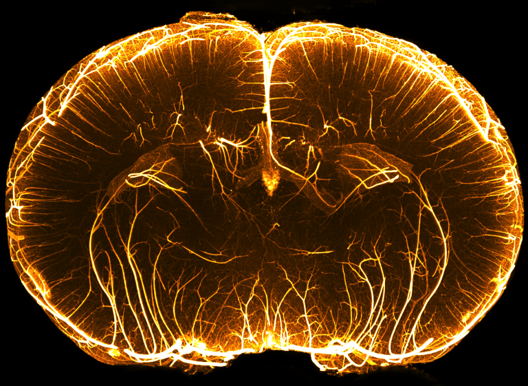 Mouse Brain Vasculature - CERMO-FC